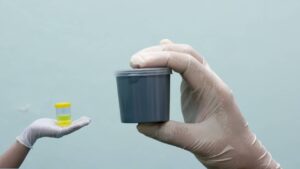 Exame de Fezes e Urina: O que é, para que serve e quando fazer?