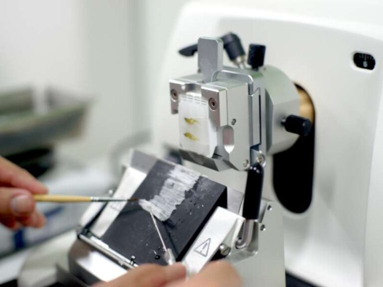 Biópsia: o que é, tipos de exame e como é feito - BoaConsulta