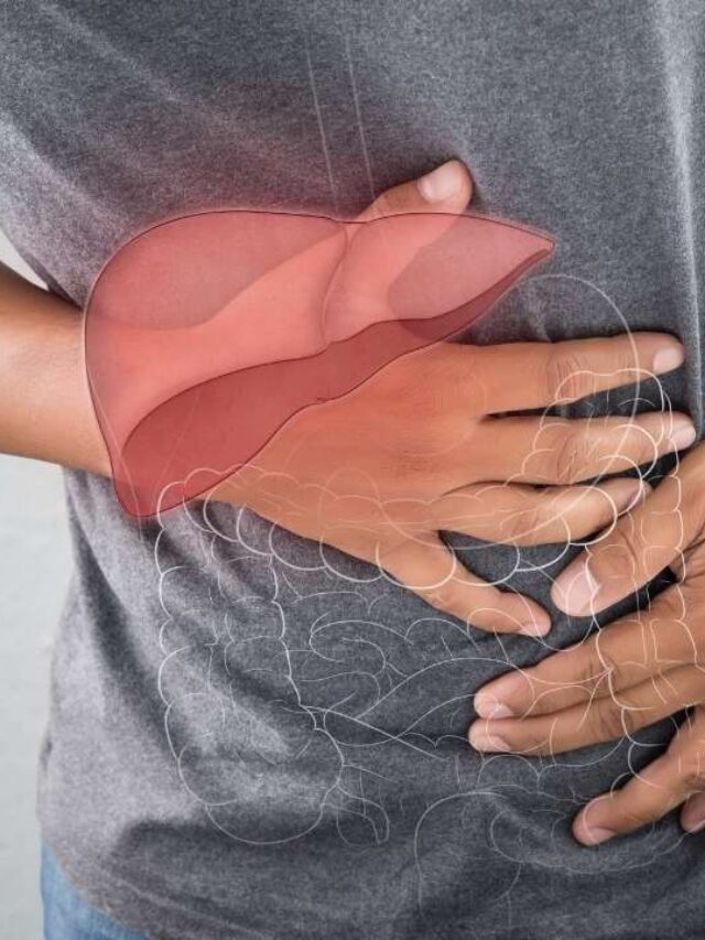 Cirrose Hepática: o que é, sintomas, causas e tratamento - BoaConsulta